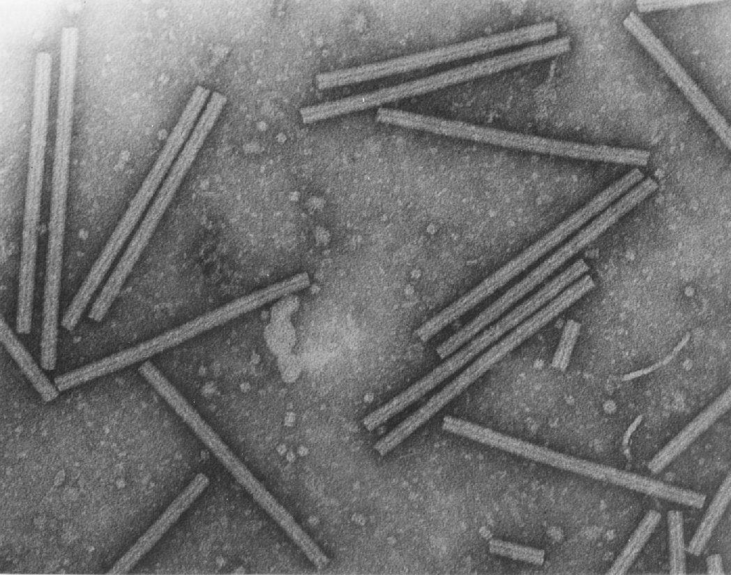 Beijerinck: 120 anni dalla scoperta dei virus - Microbiologia Italia