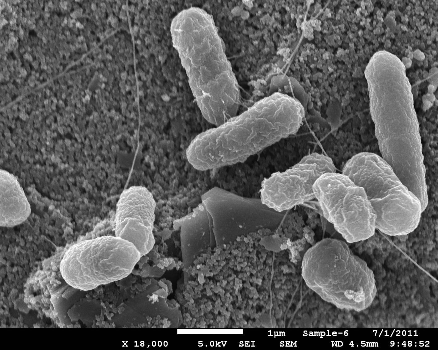 Escherichia coli – scheda batteriologica ed approfondimenti