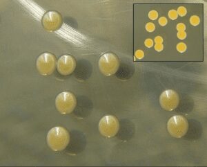 Tryptic Soy Agar – scheda del terreno di coltura per microbiologia