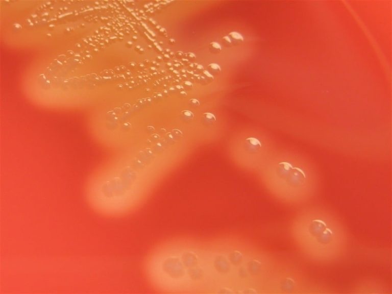 Streptococcus pyogenes – scheda batteriologica ed approfondimenti