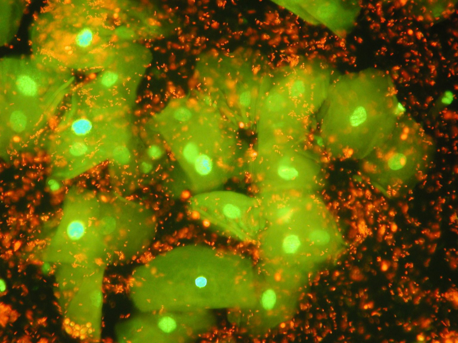 Microscopio a fluorescenza: cos'è e come funziona