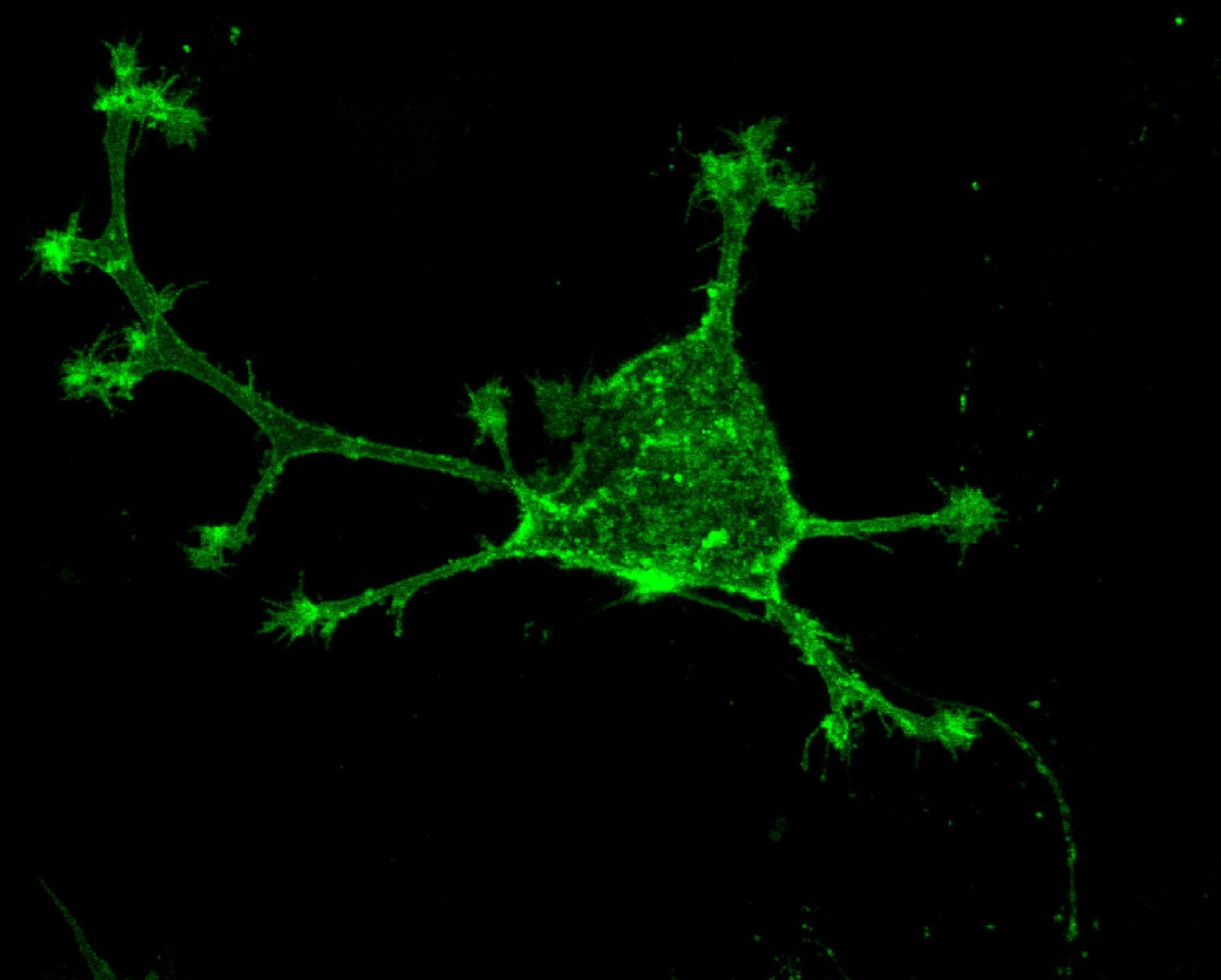 Microscopio a fluorescenza: cos'è e come funziona