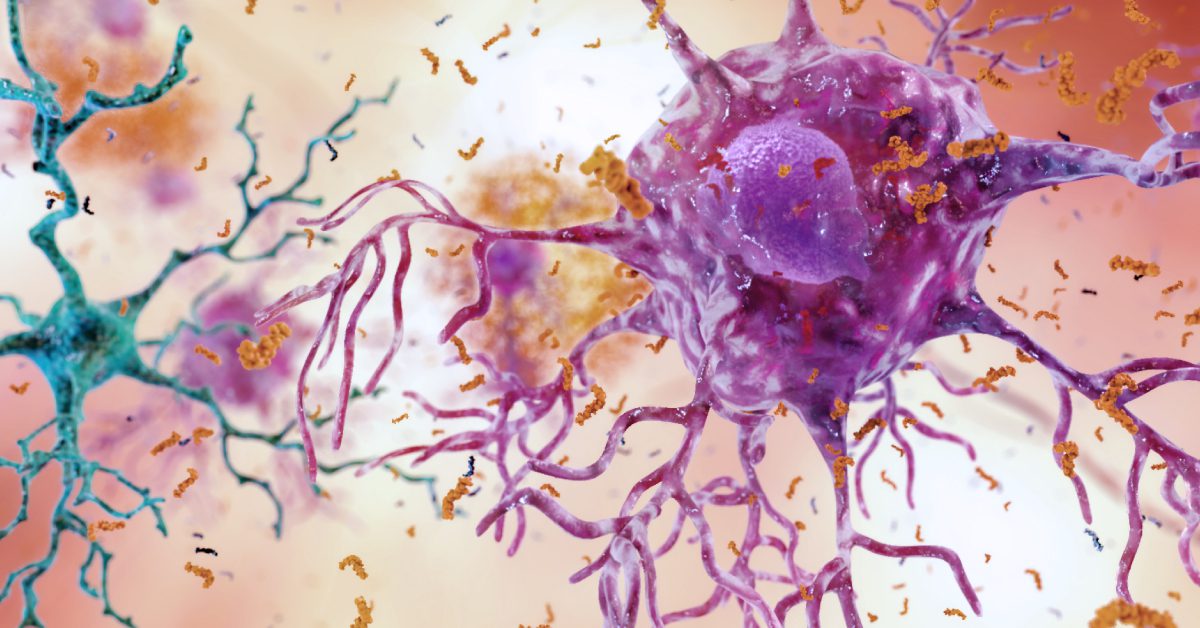 Microbiota e Alzheimer: un nuovo meccanismo biologico