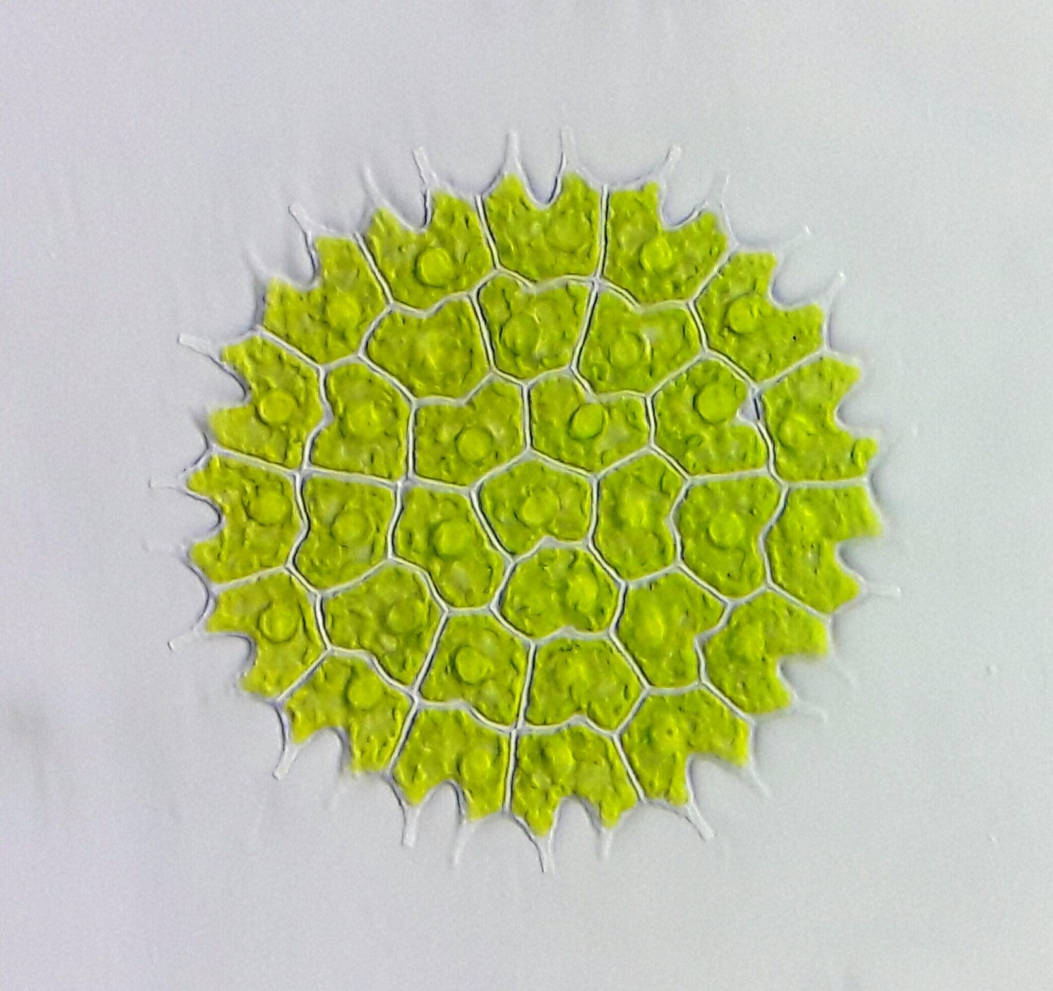 Pediastrum spp - scheda di Pediastrum spp e approfondimenti