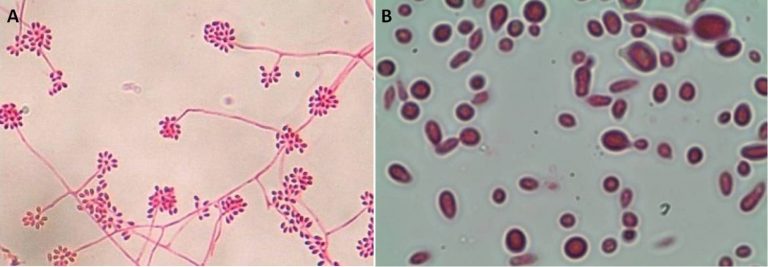 Sporothrix schenckii - Scheda micologica e approfondimenti