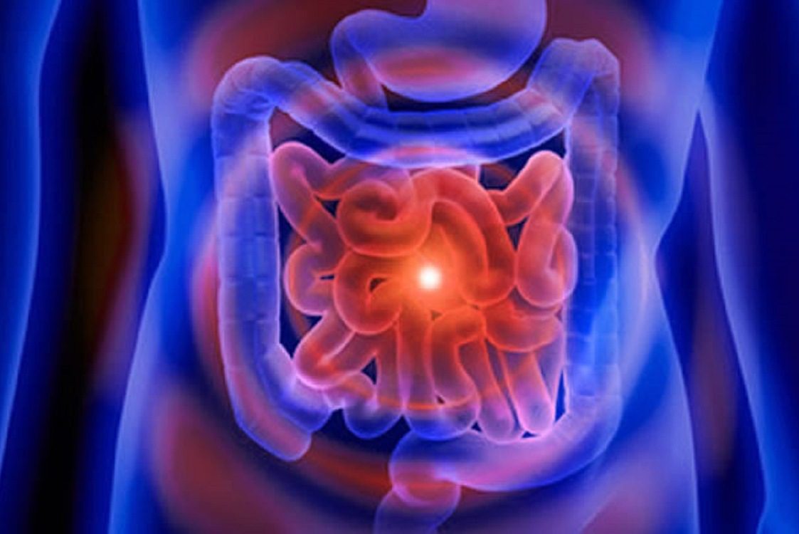 Malattia Infiammatoria cronica intestinale (IBD): quanto sappiamo