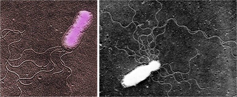 Bartonella bacilliformis - Scheda batteriologica e approfondimenti
