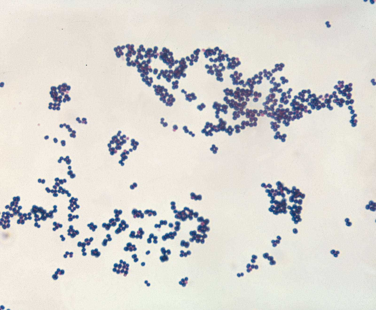 Staphylococcus aureus e l'antibiotico-resistenza - Microbiologia Italia