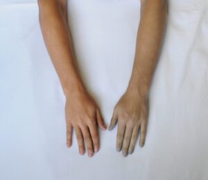 Cosa è la Tanatologia e le varie fasi di decomposizione cadaverica?
