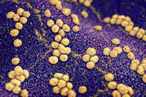 Spectra™ MRSA Medium - Microbiologia Italia
