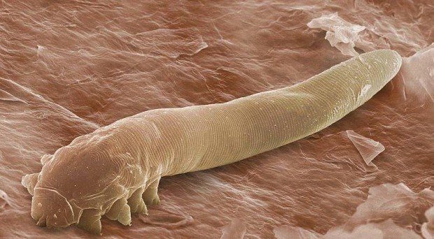 Bisogna Preoccuparsi della Presenza di Demodex follicorum?