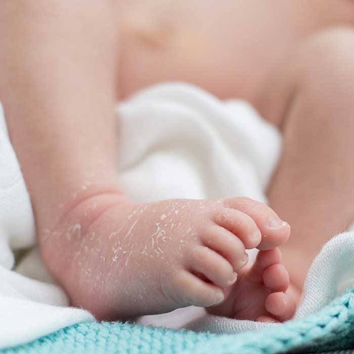 Problemi Cutanei nei Bambini: Cosa c'è da sapere?