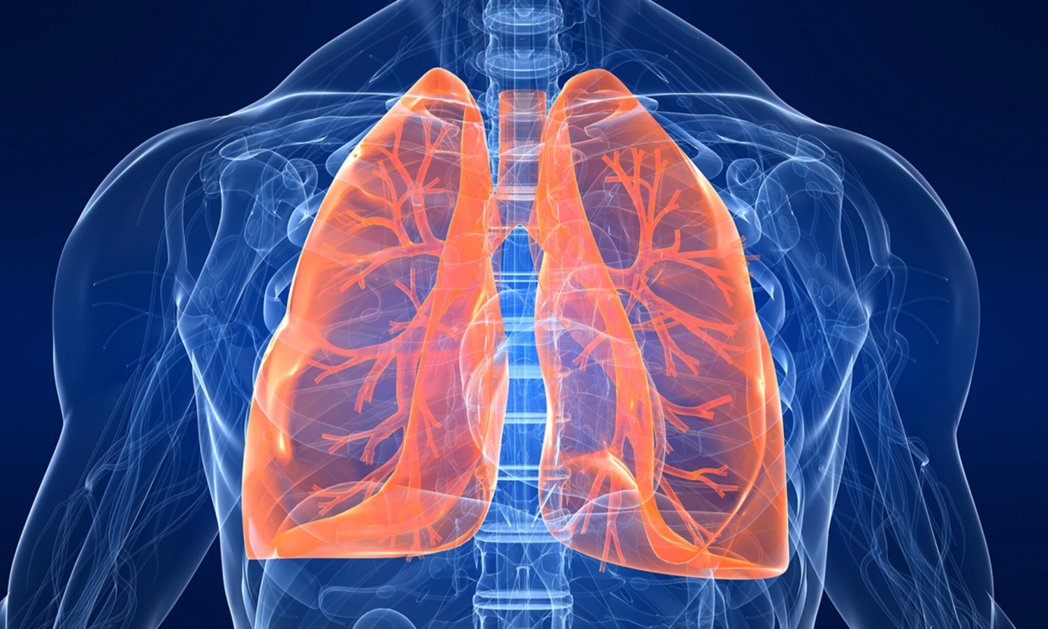 Embolia Polmonare: Cause, Sintomi, Diagnosi e Trattamento