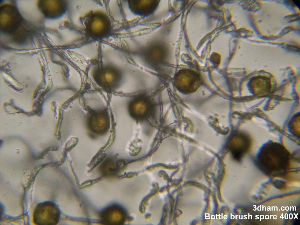 Ricerca delle Spore Batteriche: Una Guida Metodica Dettagliata