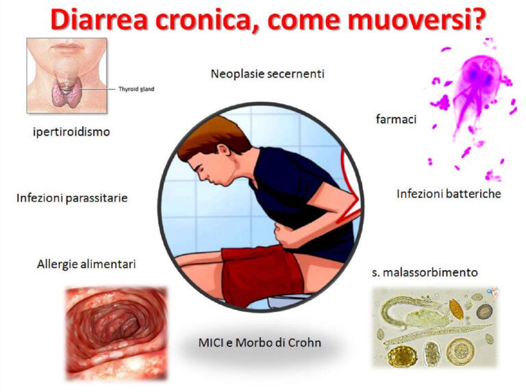 Cause della Diarrea: Un'Analisi Approfondita